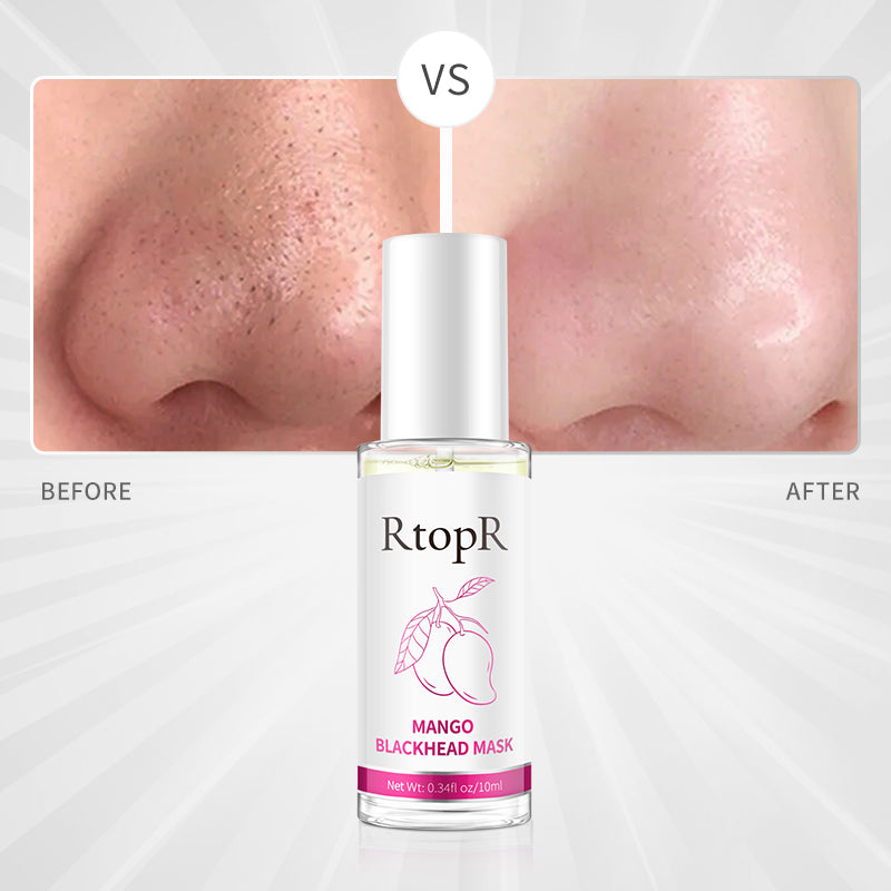 RtopR MANGO BLACKHEAD MASK | Clean Blackheads – www.rtopr.com